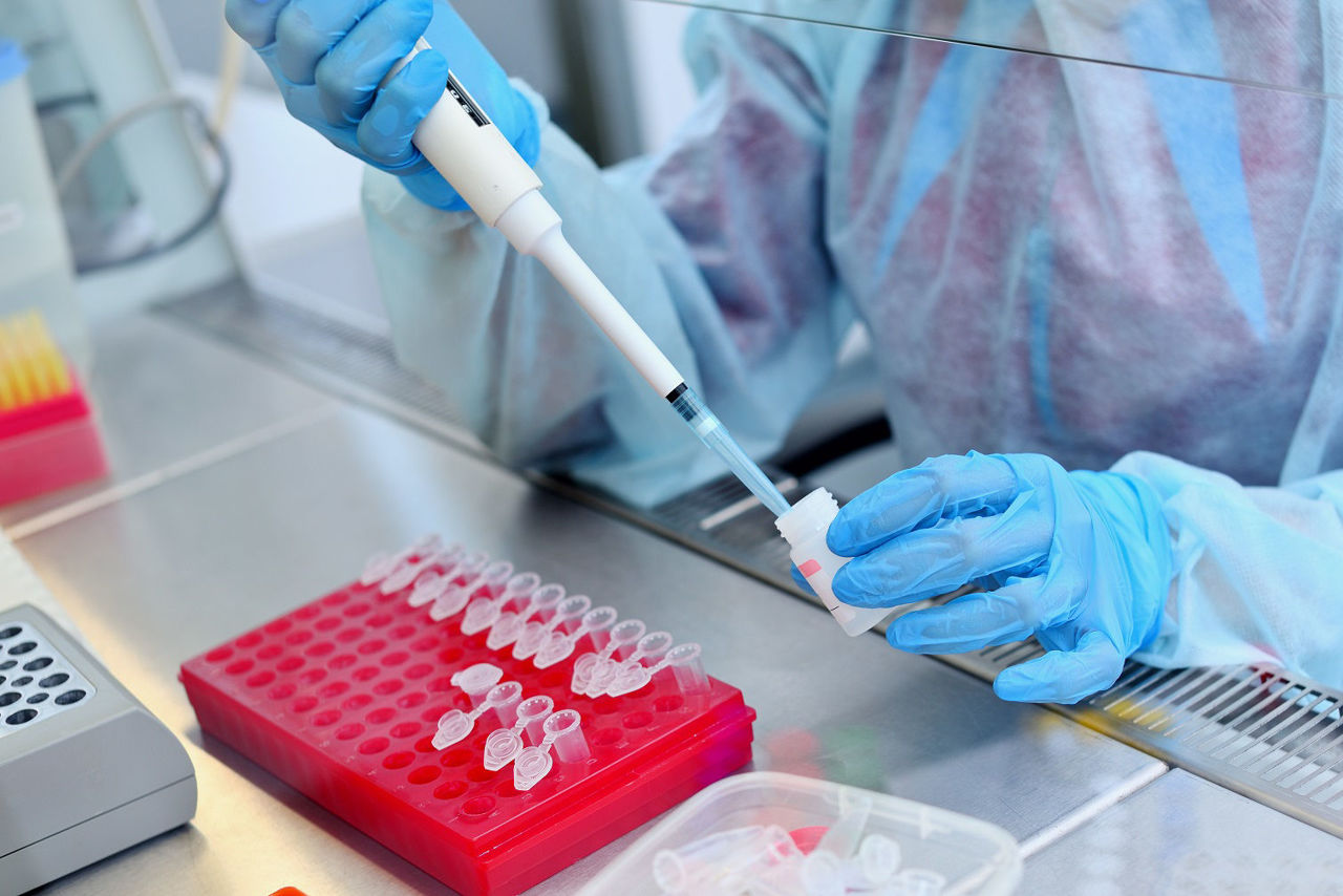 The journey of my dog’s sample in the genetic lab. Step 1 | DNA tests ...